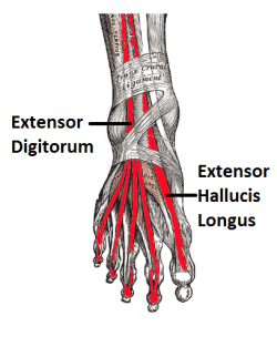 Extensor Tendonitis: Top of Foot Pain
