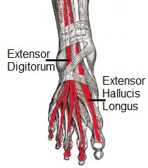 Extensor Tendonitis: Top of Foot Pain