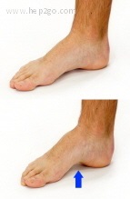 Foot & Ankle Strengthening Exercises - Foot Pain Explored