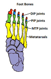 Hammer, Claw & Mallet Toe