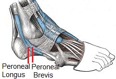 Peroneal Tendonitis: Causes, Symptoms & Treatment